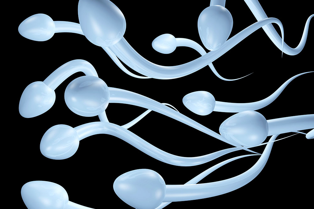 6 passos para entender a análise de um Espermograma Completo ...